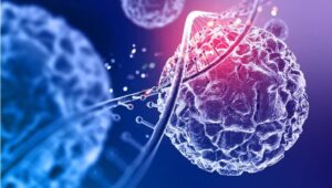 Marginal Zone B Cell Lymphoma - Marginal Zone Lymphoma Info